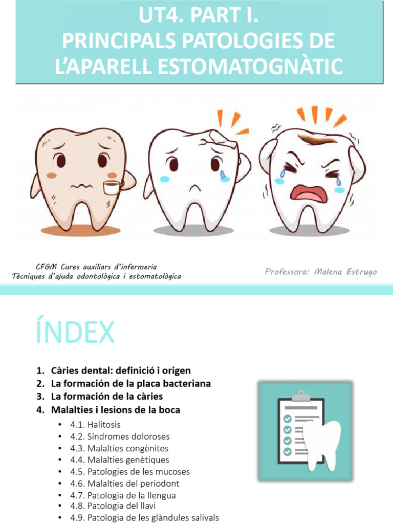 Presentació Ud4 - Part 1 | PDF