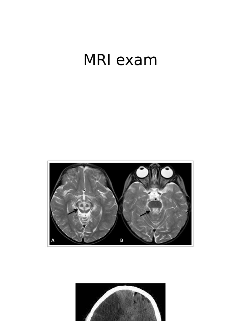 MRI Exam | PDF