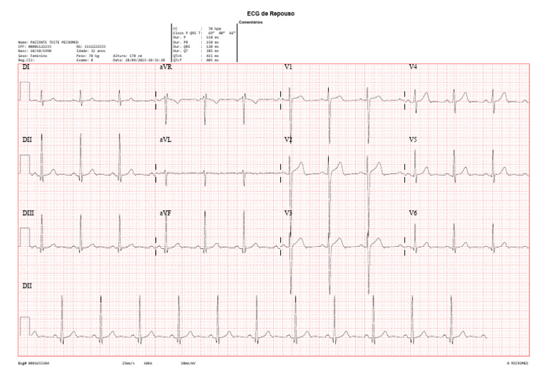 Laudo de ECG de Repouso | PDF