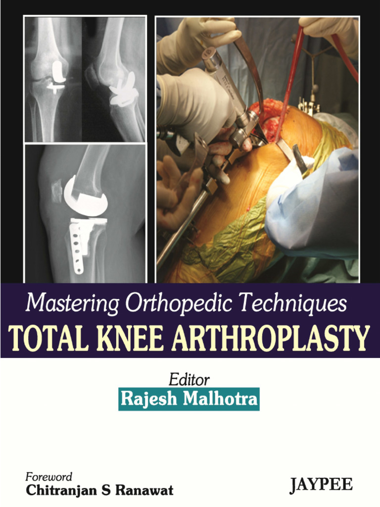 Total Knee Arthroplasty | PDF | Knee | Orthopedic Surgery