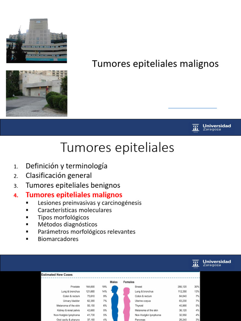 Clase 15. Tumores Epiteliales Malignos | PDF | Epitelio | Neoplasias