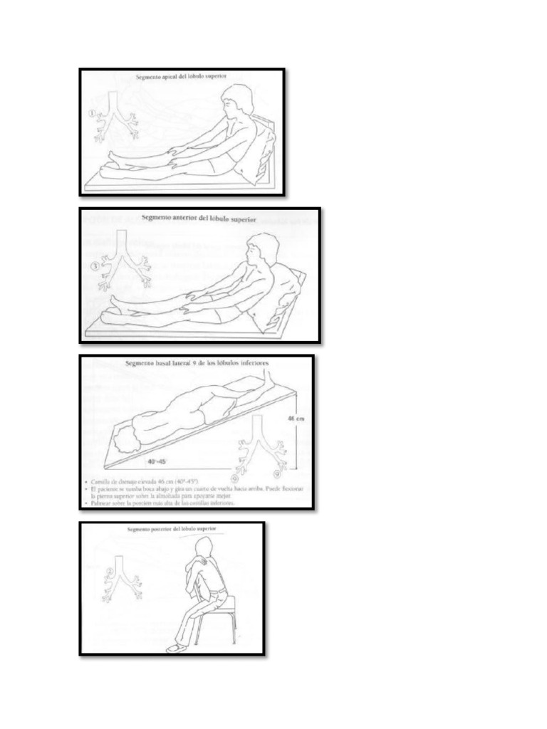 Drenaje Postural | PDF