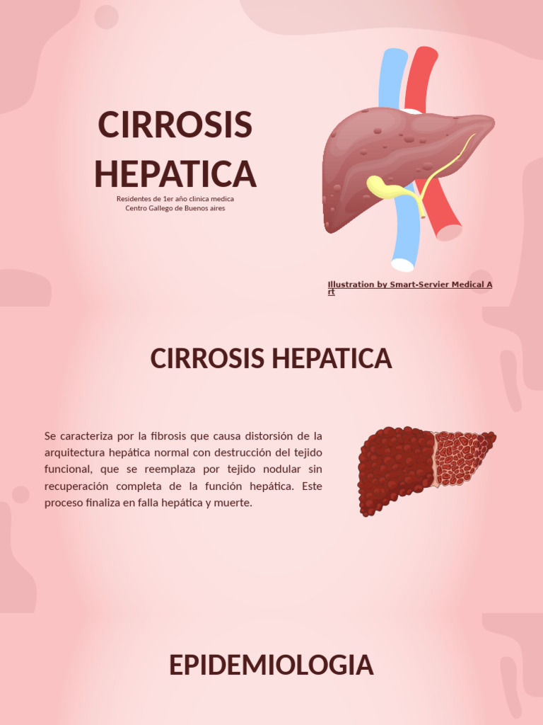 Cirrosis Hepatica | PDF