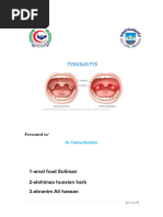 Tonsilitis | PDF | Human Diseases And Disorders | Immunology