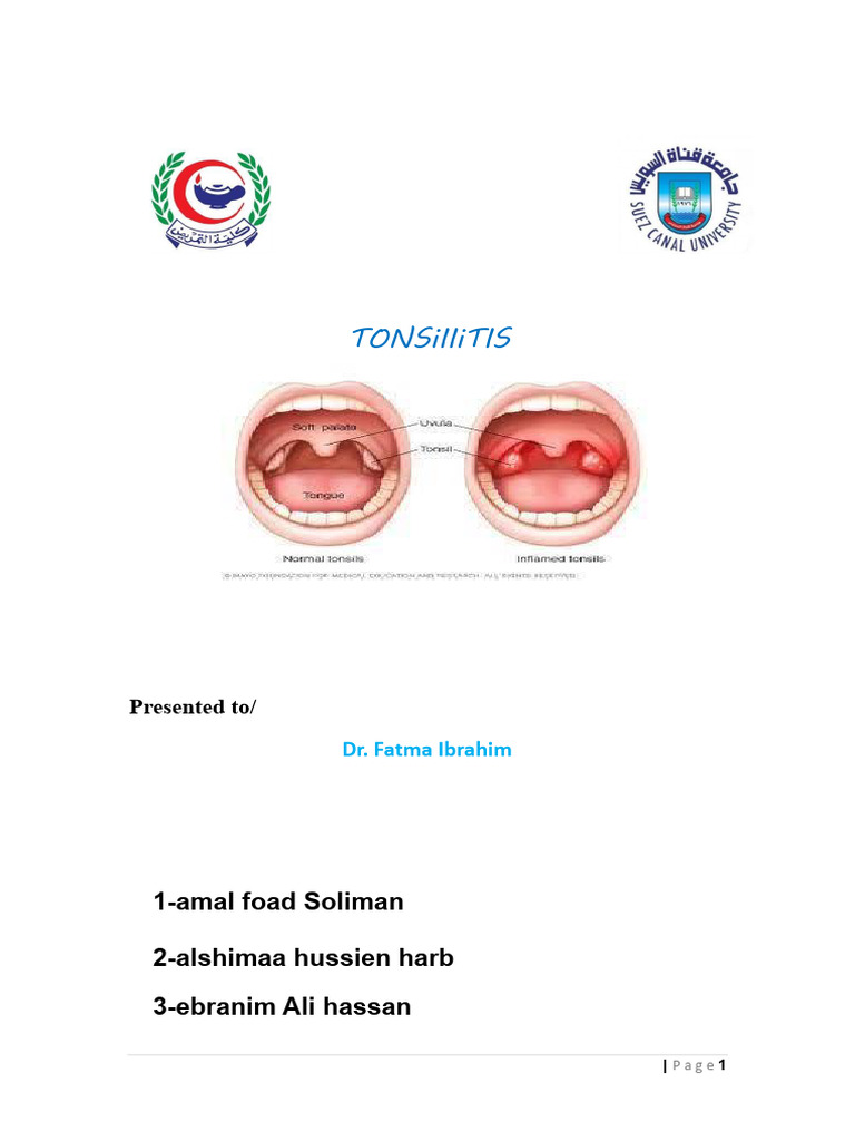 Tonsillitis Presentation | PDF | Medicine | Epidemiology