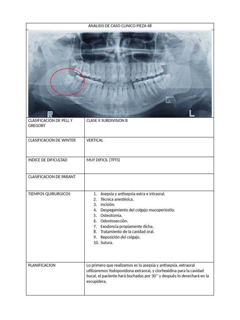 Analisis de Caso CX | PDF