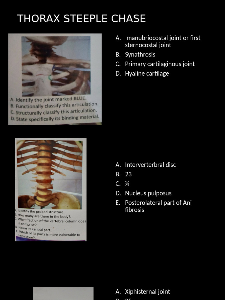 Thorax Steeple Chase | PDF | Atrium (Heart) | Coronary Circulation