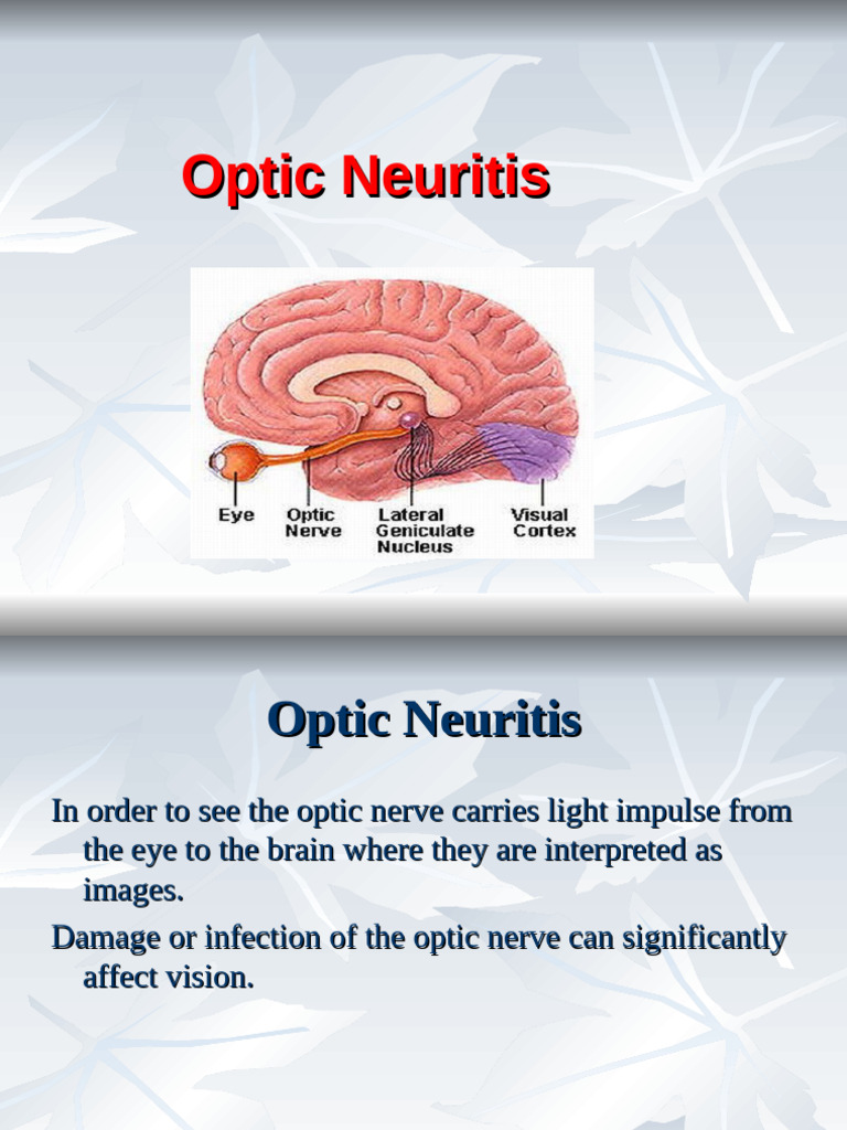 Optic Neuritis | PDF | Multiple Sclerosis | Medicine