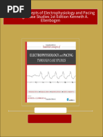 EKG Pocket Guide | PDF | Cardiac Electrophysiology | Electrocardiography