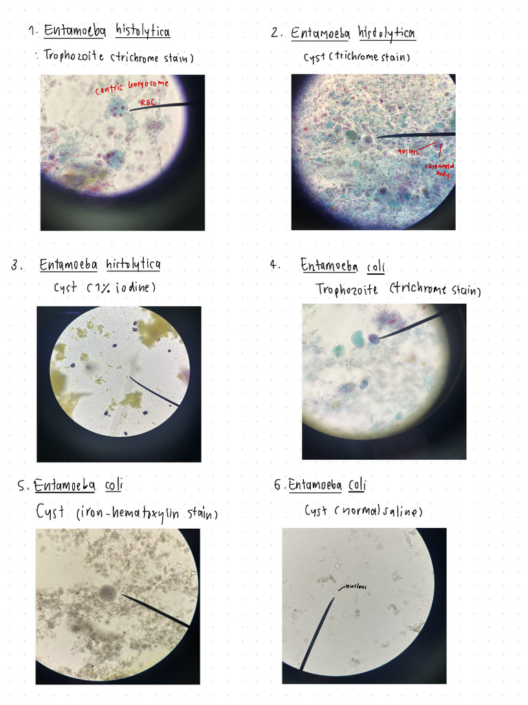 Parasitology Lab - Midterm | PDF | Plasmodium | Parasitology