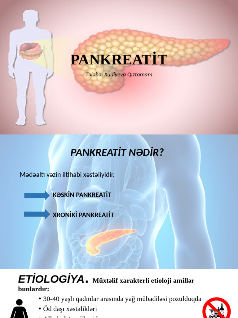 Pankreatit 1 | PDF