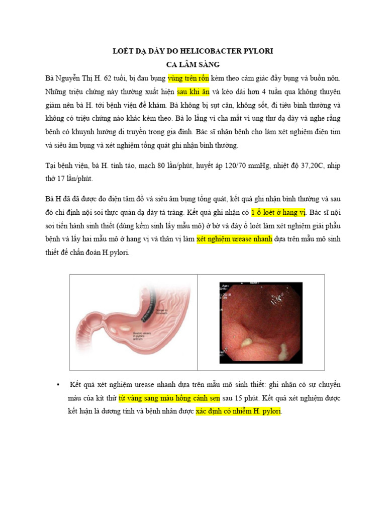 Loét Dạ Dày Do Helicobacter Pylori-1 | PDF