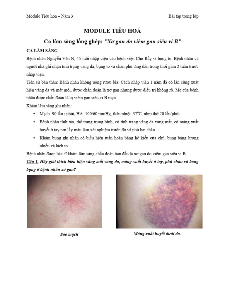 Bai Tap Trong Lop-Xo Gan | PDF