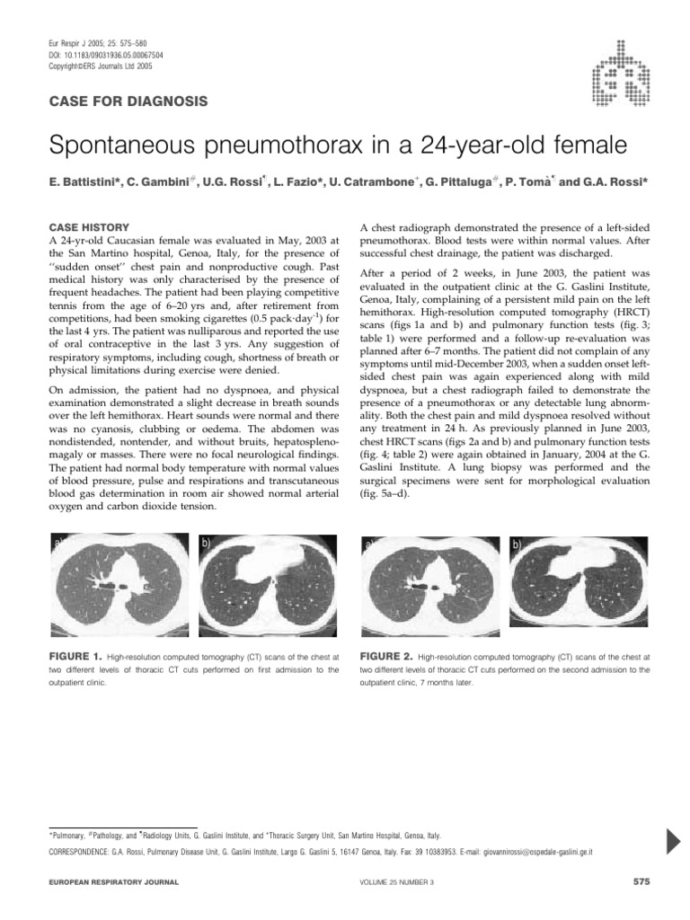 No. 7. 575.full - Pneumothorax | PDF | Lung | Medical Specialties
