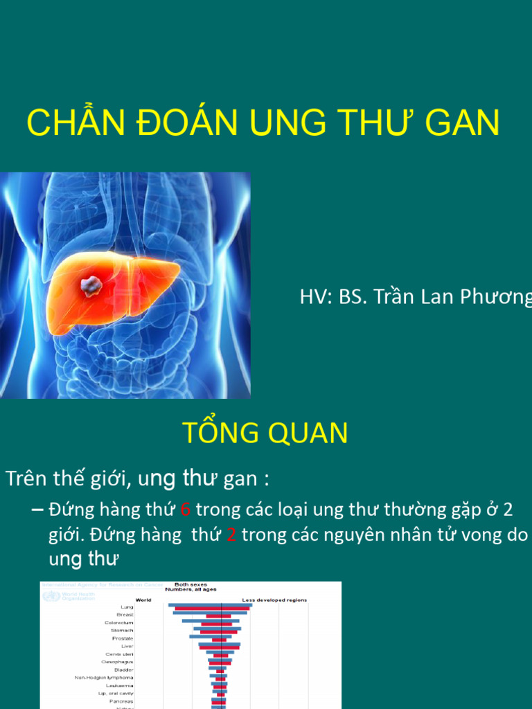 K Gan - Chẩn đoán | PDF