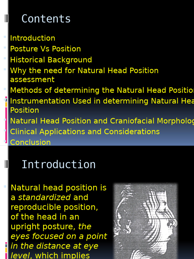 Natural Head Position | PDF