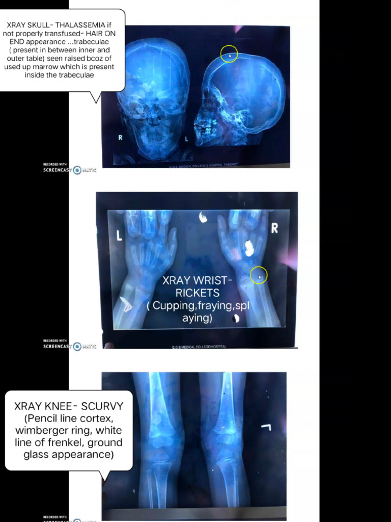 Paeds Practical | PDF
