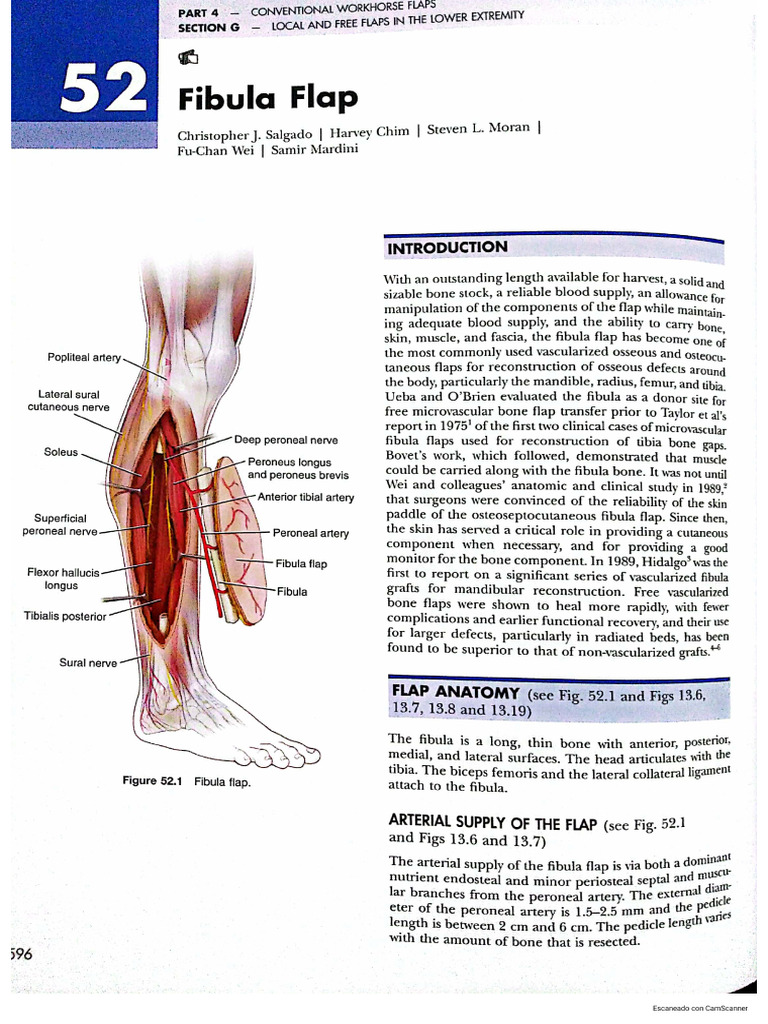 Fu Chan Wei - Fibula Flap | PDF