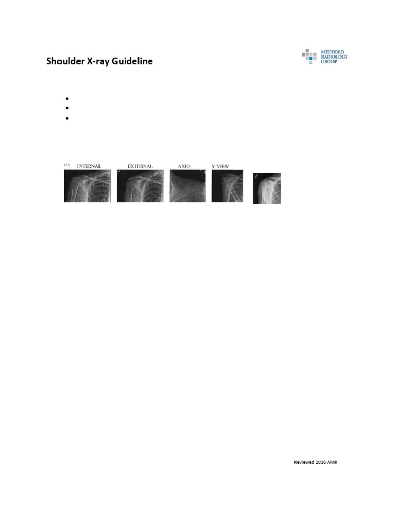 Shoulder X-ray Guidelines: 3 Views | PDF