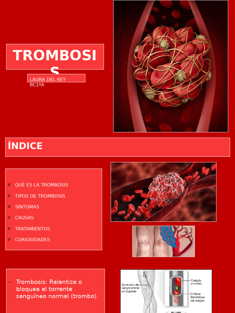 Guía Completa sobre Trombosis | PDF | Trombosis | Embolia