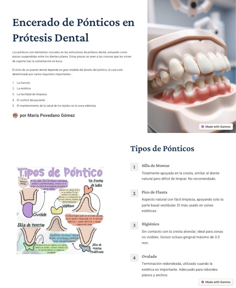 Tipos de Pónticos en Prótesis Dental | PDF | Hogar, jardinería y bricolaje