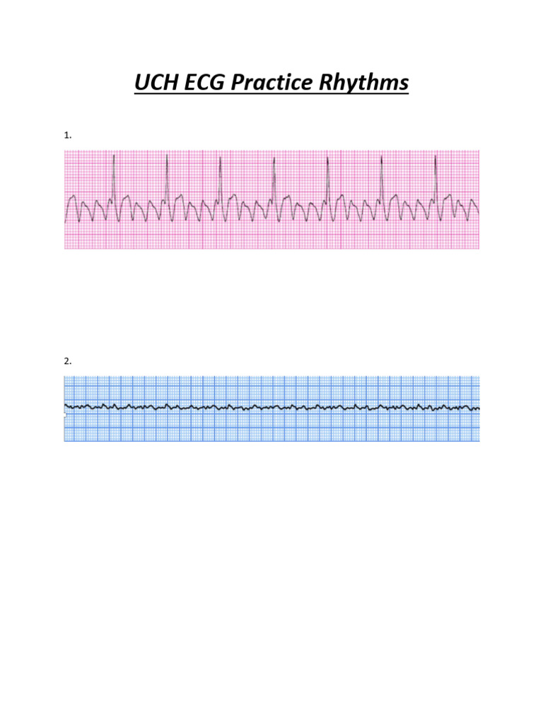 ECG Rhythm Practice for Nurses | PDF | Cardiology | Cardiac ...