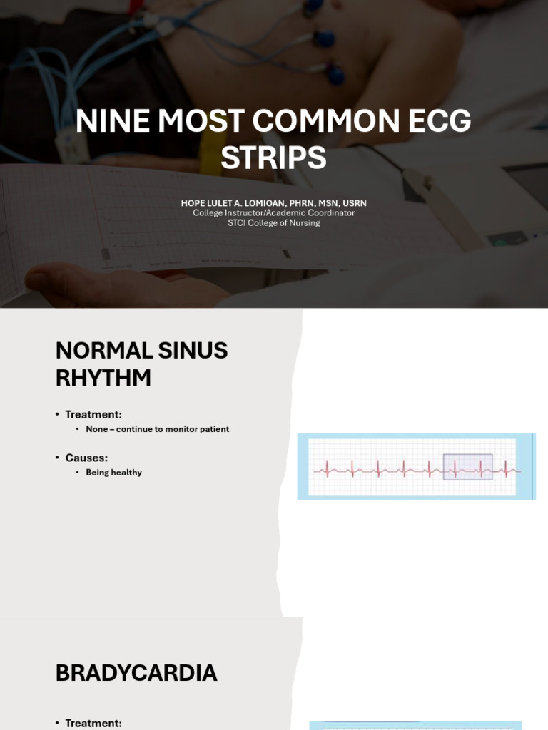 Nine Most Common ECG Strips | PDF | Electrocardiography | Atrium (Heart)