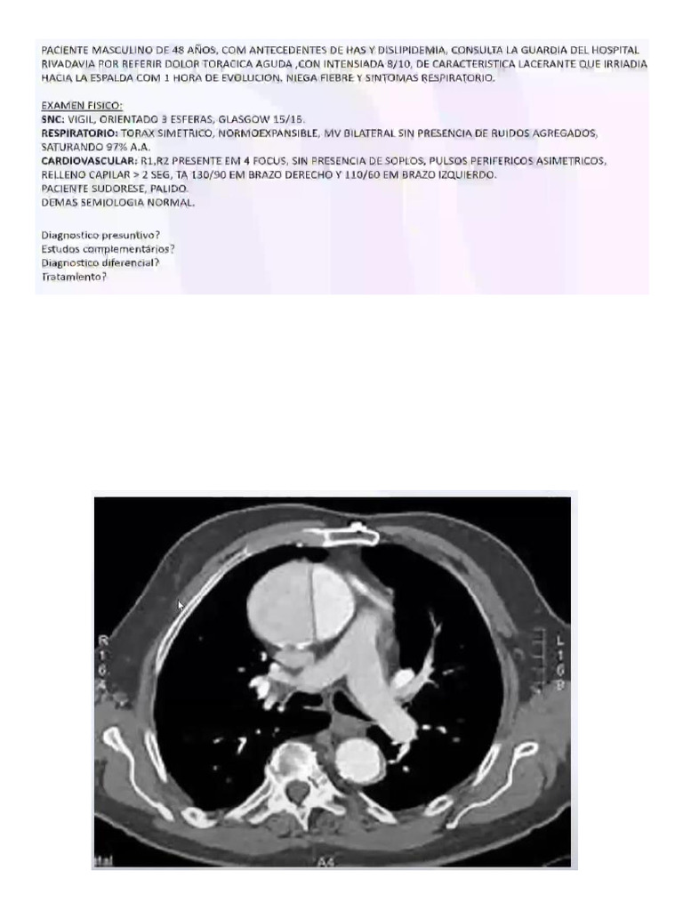 Caso Clinico 1 | PDF