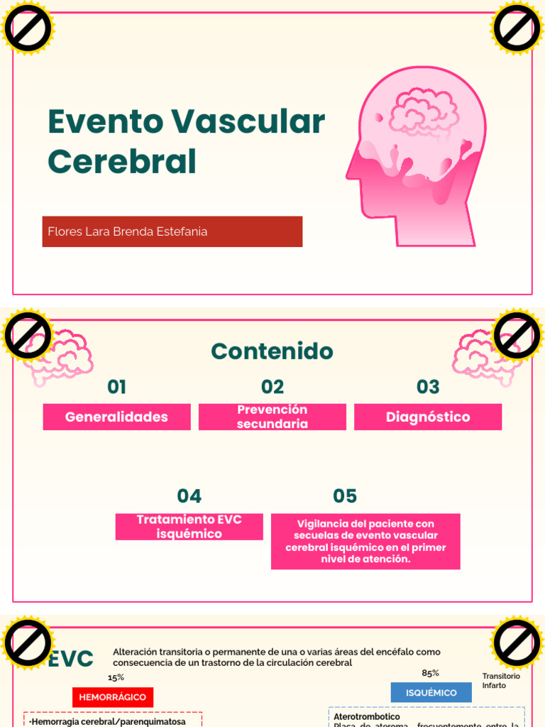 Evento Vascular Cerebral: Flores Lara Brenda Estefania | PDF | Carrera | Enfermedades vasculares