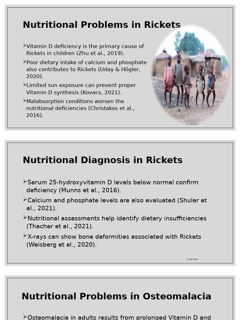 Nutritional Problems, Nutritional Diagnosis and Conclision of Ricket ...