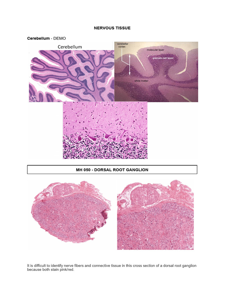 Nervous Tissue Lymphatic Tissue | PDF | Lymph Node | Lymphatic System
