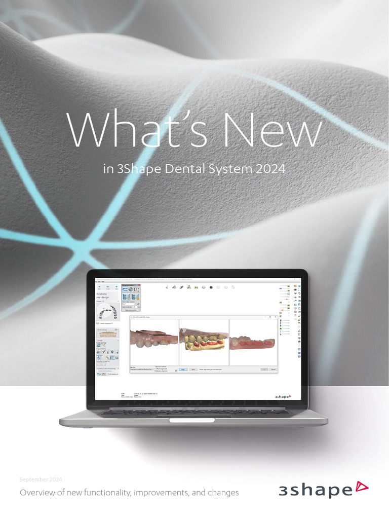 3Shape Dental System 2024 Updates | PDF | Solid State Drive | Simulation
