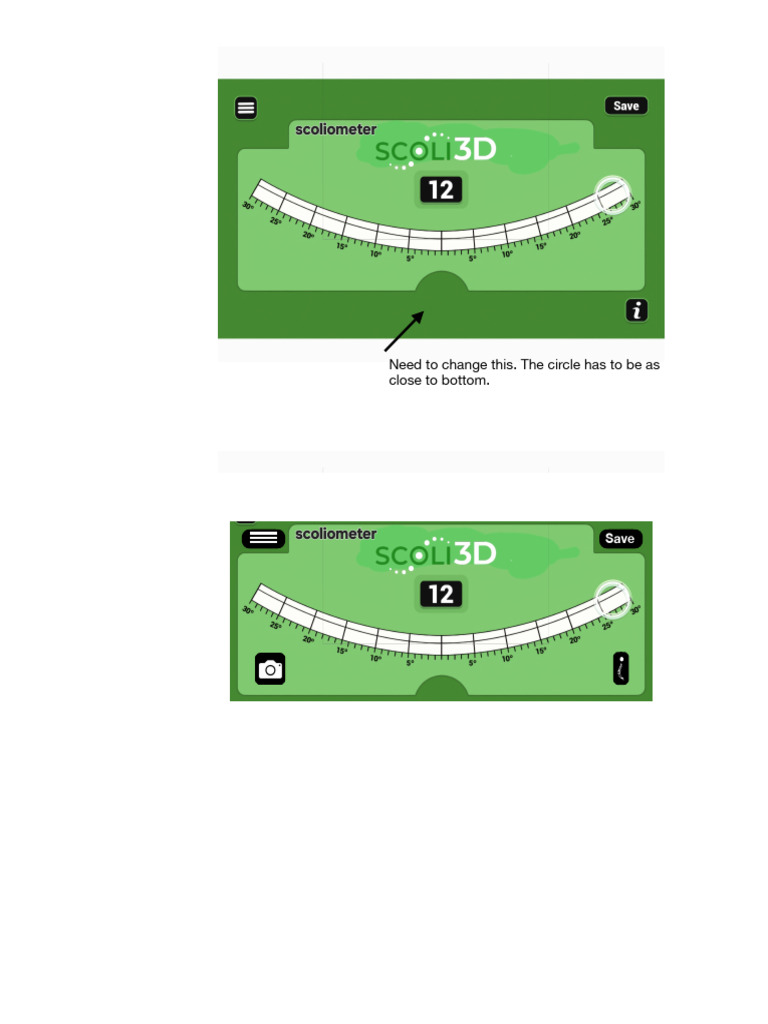 Scoliometer Screen | PDF Scoliometer Screen | PDF