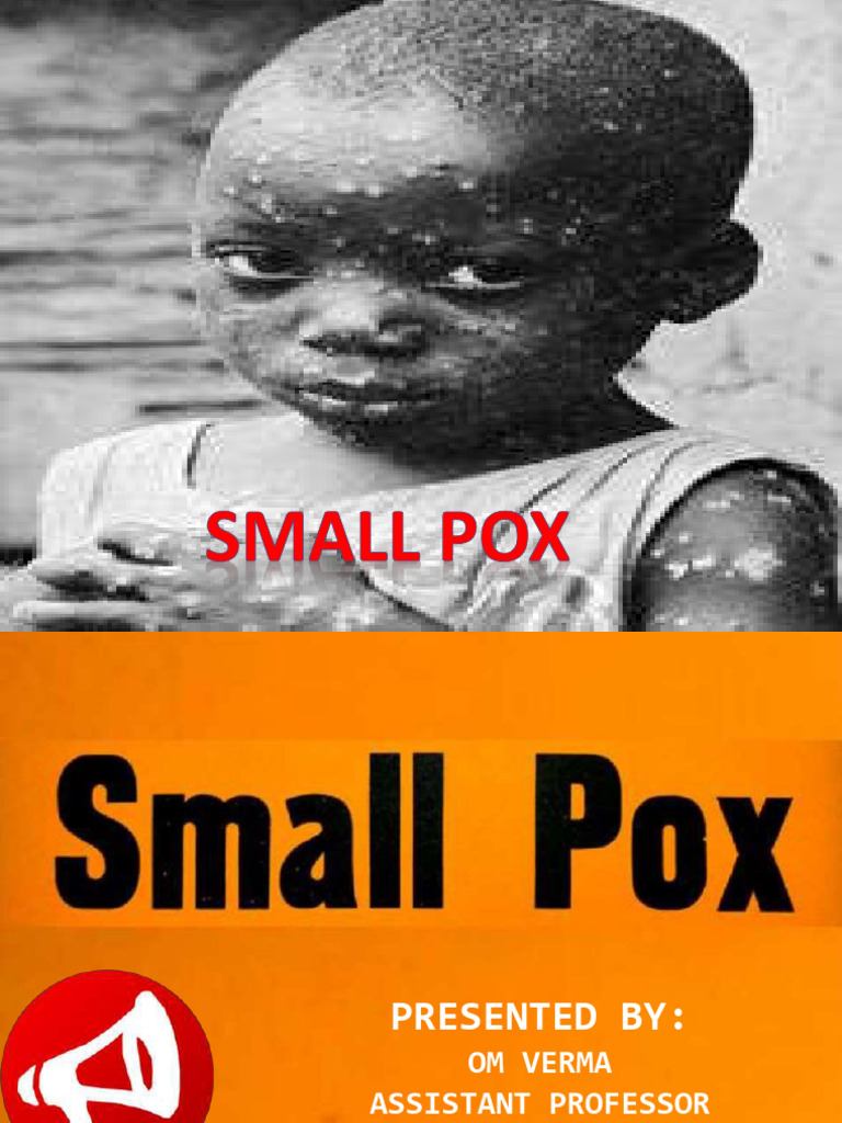 Smallpox 200728161325 | PDF | Smallpox | Infection