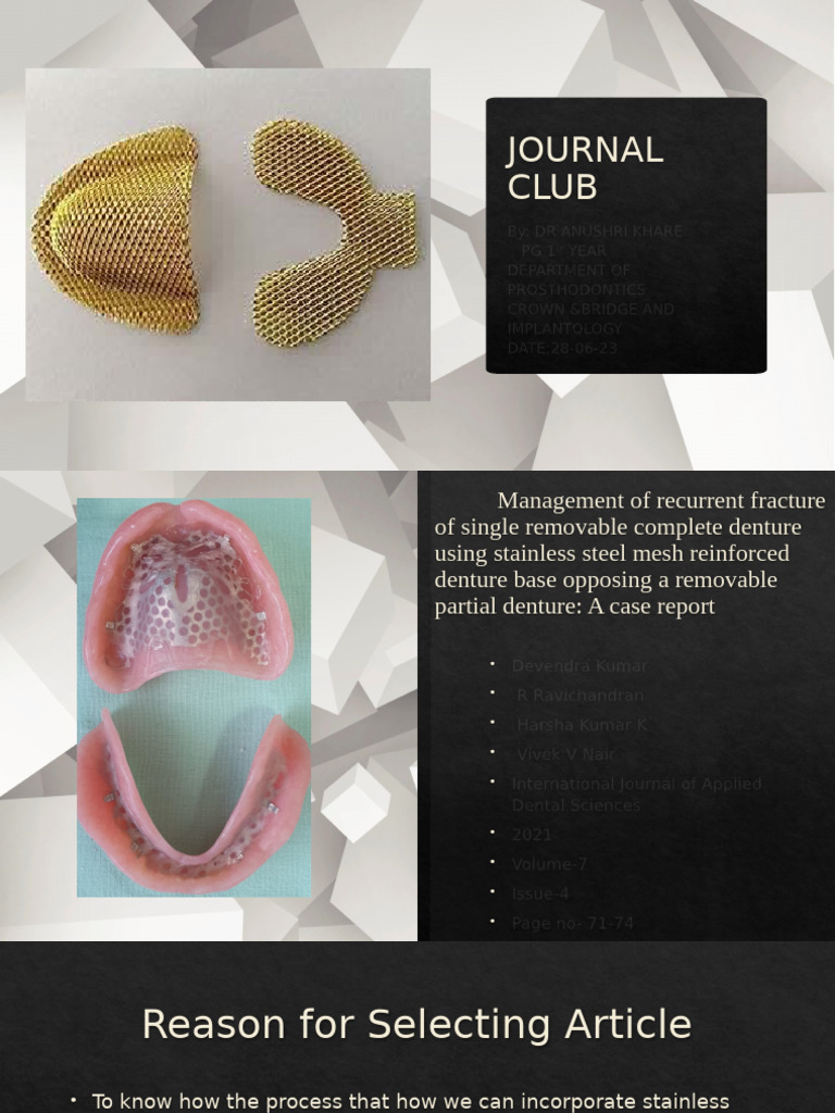 Management of Recurrent Fracture of Sinle Removable CD Using Stainless ...