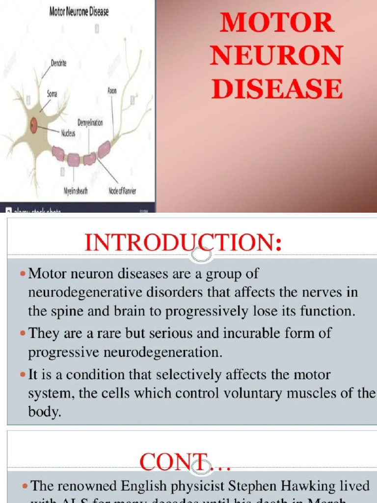 Motor Neuron Disease | PDF