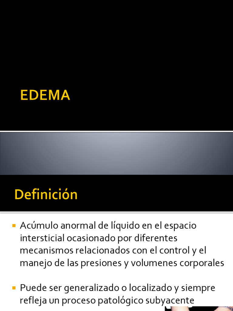 Sindrome Edematoso 240824 180433 | PDF | Edema | Enfermedades y trastornos