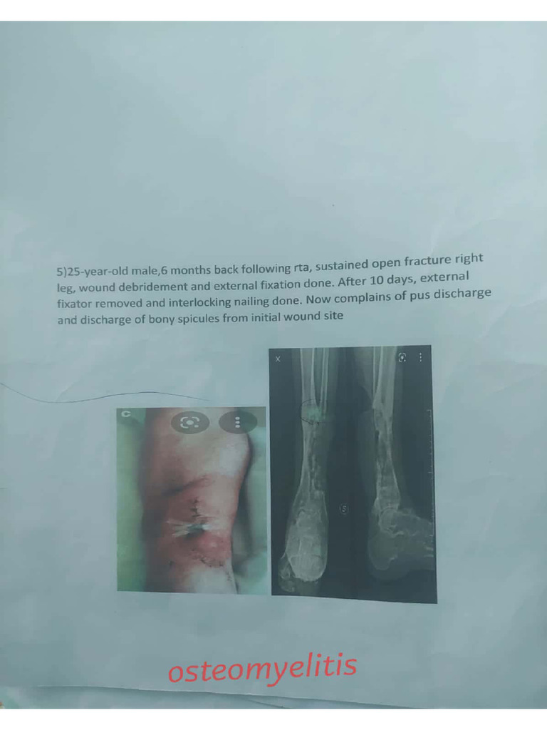 Ortho Case Ans | PDF