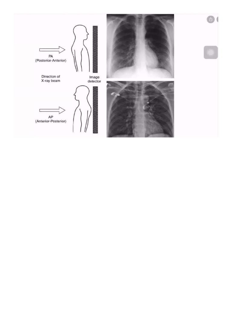 Paediatrics Xrays | PDF