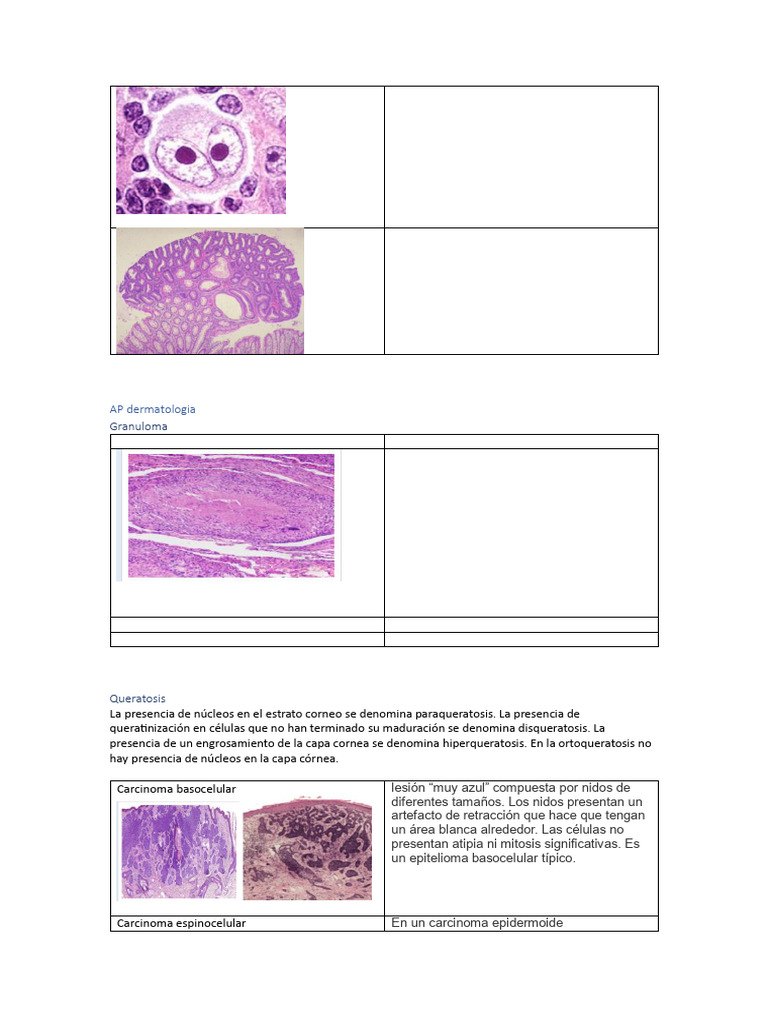 2 Rx-Anapat - Forsense Mir 2024-21-25 | PDF | Asma | Inflamación