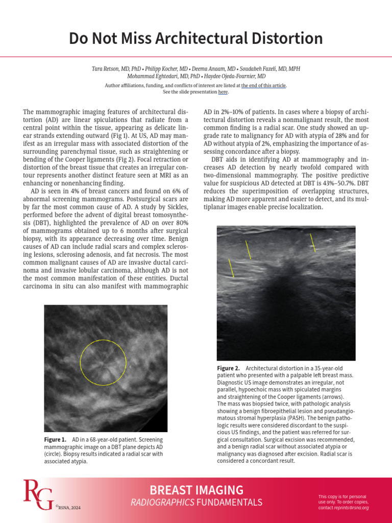 Retson Et Al 2024 Do Not Miss Architectural Distortion | PDF | Mammography | Clinical Medicine