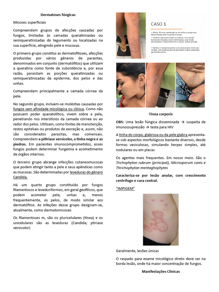 Dermatoses Fúngicas: Tipos e Tratamento | PDF | Fungo | Psoríase