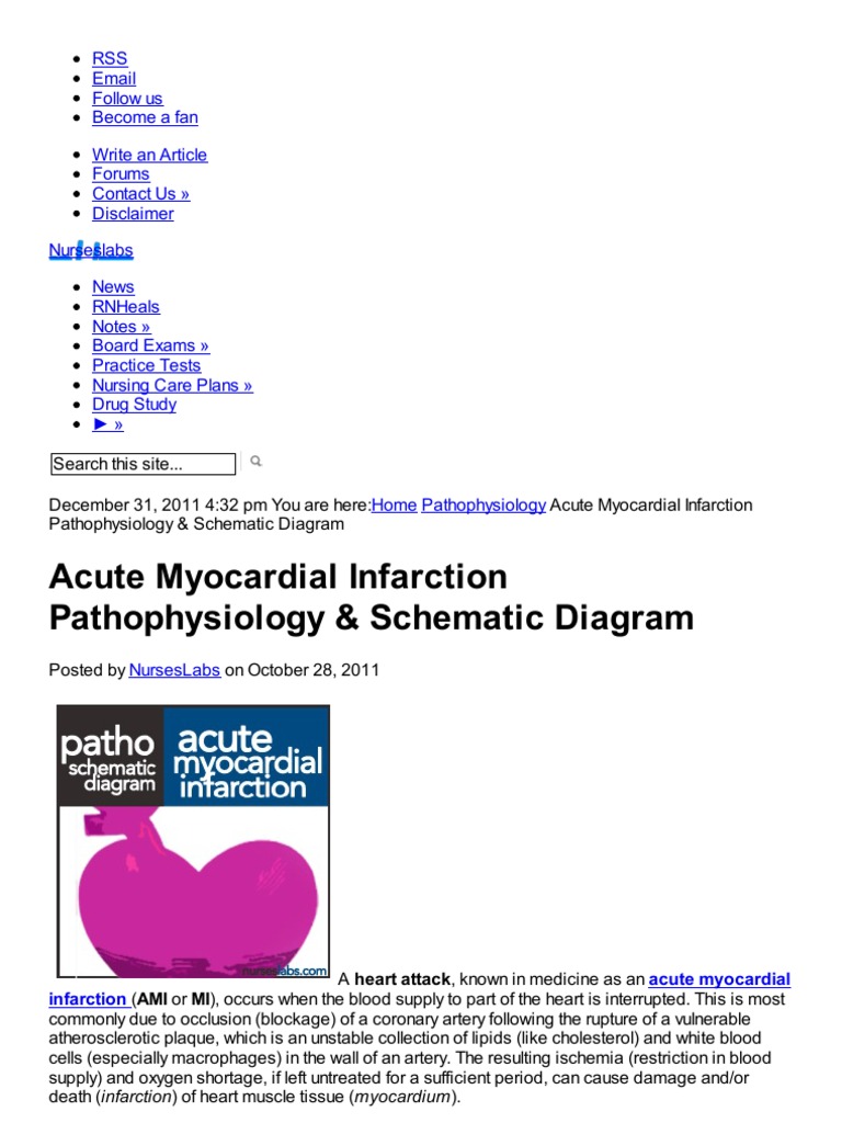 Acute Myocardial Infarction Pa Tho Physiology Amp Schematic Diagram ...