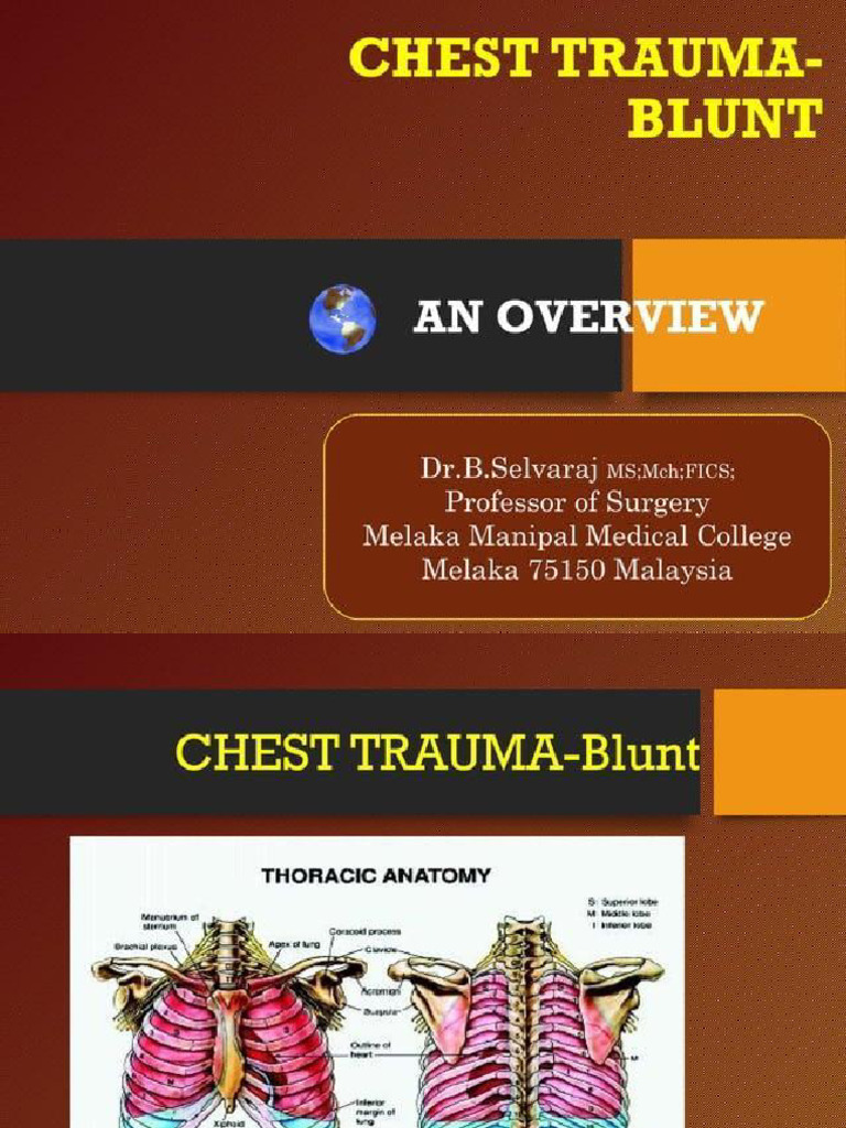 Chest Trauma | PDF