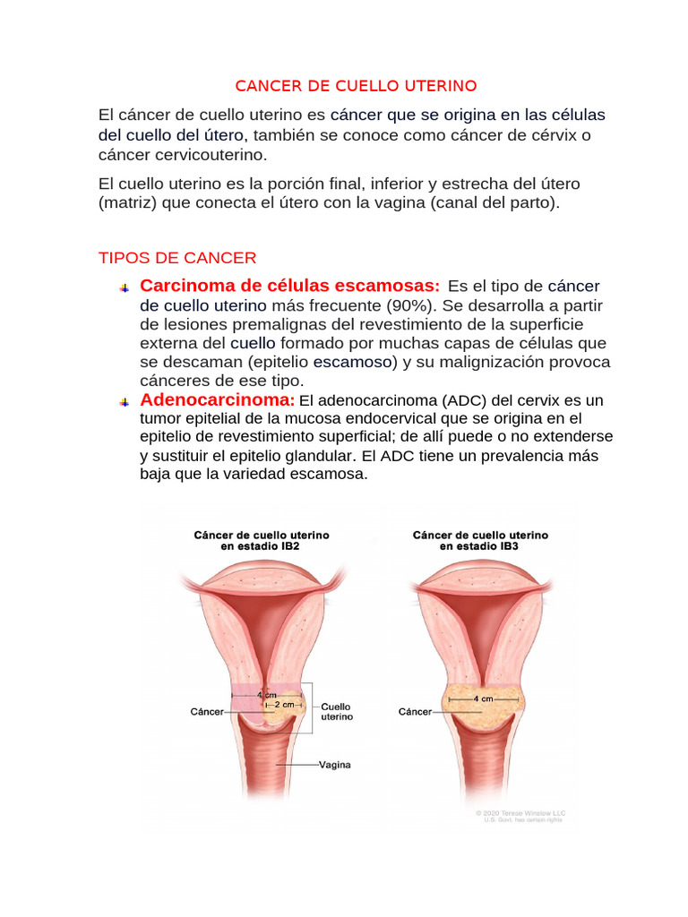 Cancer de Cuello Uterino | PDF