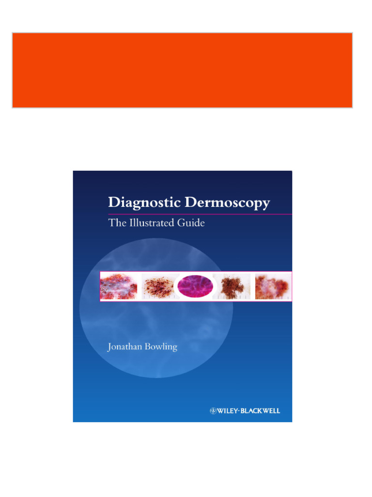 PDF Diagnostic Dermoscopy The Illustrated Guide by Jonathan Bowling Download | PDF