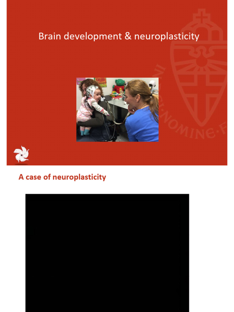 Lecture Neuroplasticity | PDF | Neuroplasticity | Cerebral Cortex
