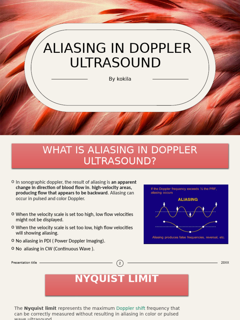 Aliasing in Ultrasound | PDF | Doppler Effect | Medical Ultrasound