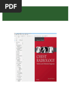 Chest X - Ray Interpretation | PDF | Lung | Thorax