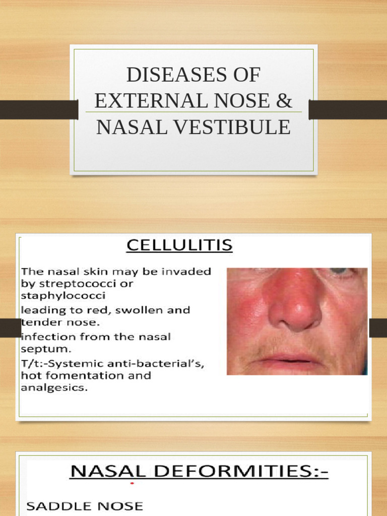 Diseases of External Nose & Nasal Vestibule | PDF